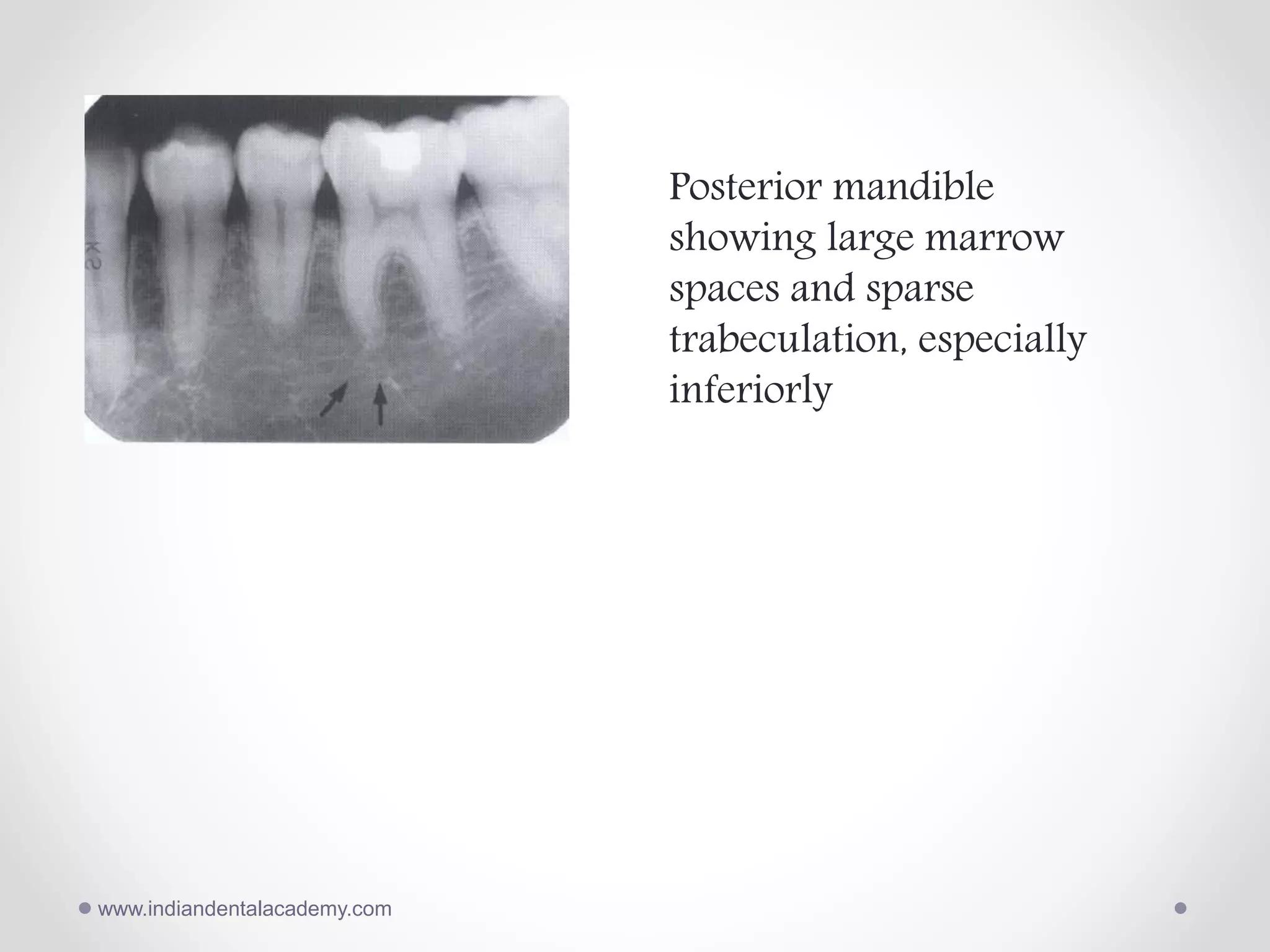 Anatomic radiopacities / dental implant courses | PPT