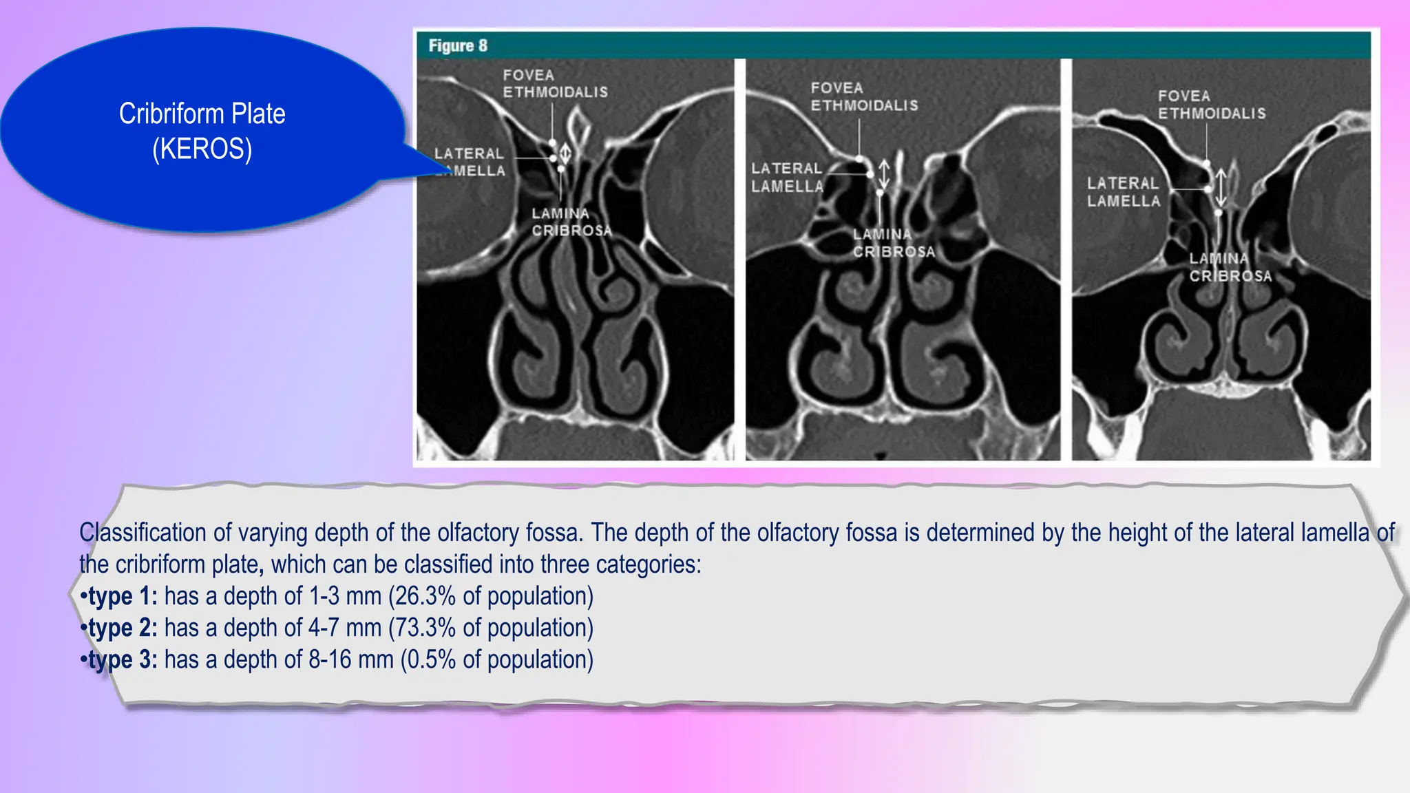 anatomi based on CT scan sinus paranasal imaging | PPT