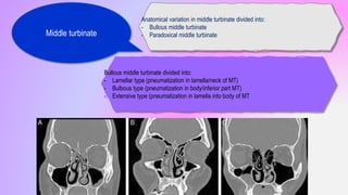 anatomi based on CT scan sinus paranasal imaging | PPTX
