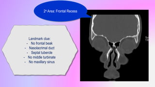 anatomi based on CT scan sinus paranasal imaging | PPTX