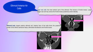 anatomi based on CT scan sinus paranasal imaging | PPTX
