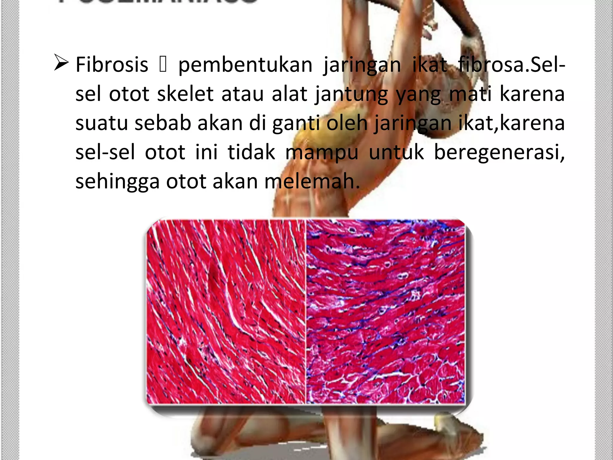 Anatomi dan fisiologi sistem otot | PPT