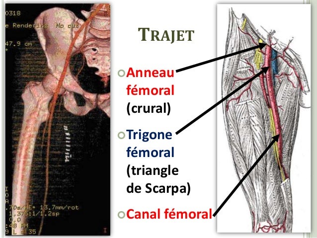 Anatomie arteres du membre inferieur