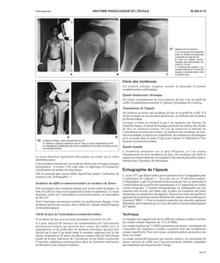 Anatomie radiologique de l'épaule | PDF
