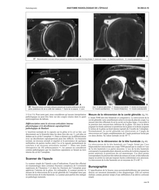 Anatomie radiologique de l'épaule | PDF