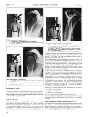 Anatomie radiologique de l'épaule | PDF