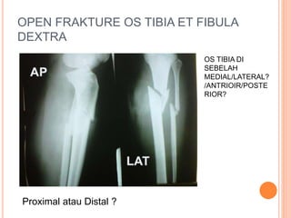 Anatomi fisiologi umum | PPTX