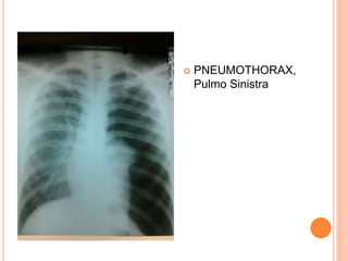 Anatomi fisiologi umum | PPTX