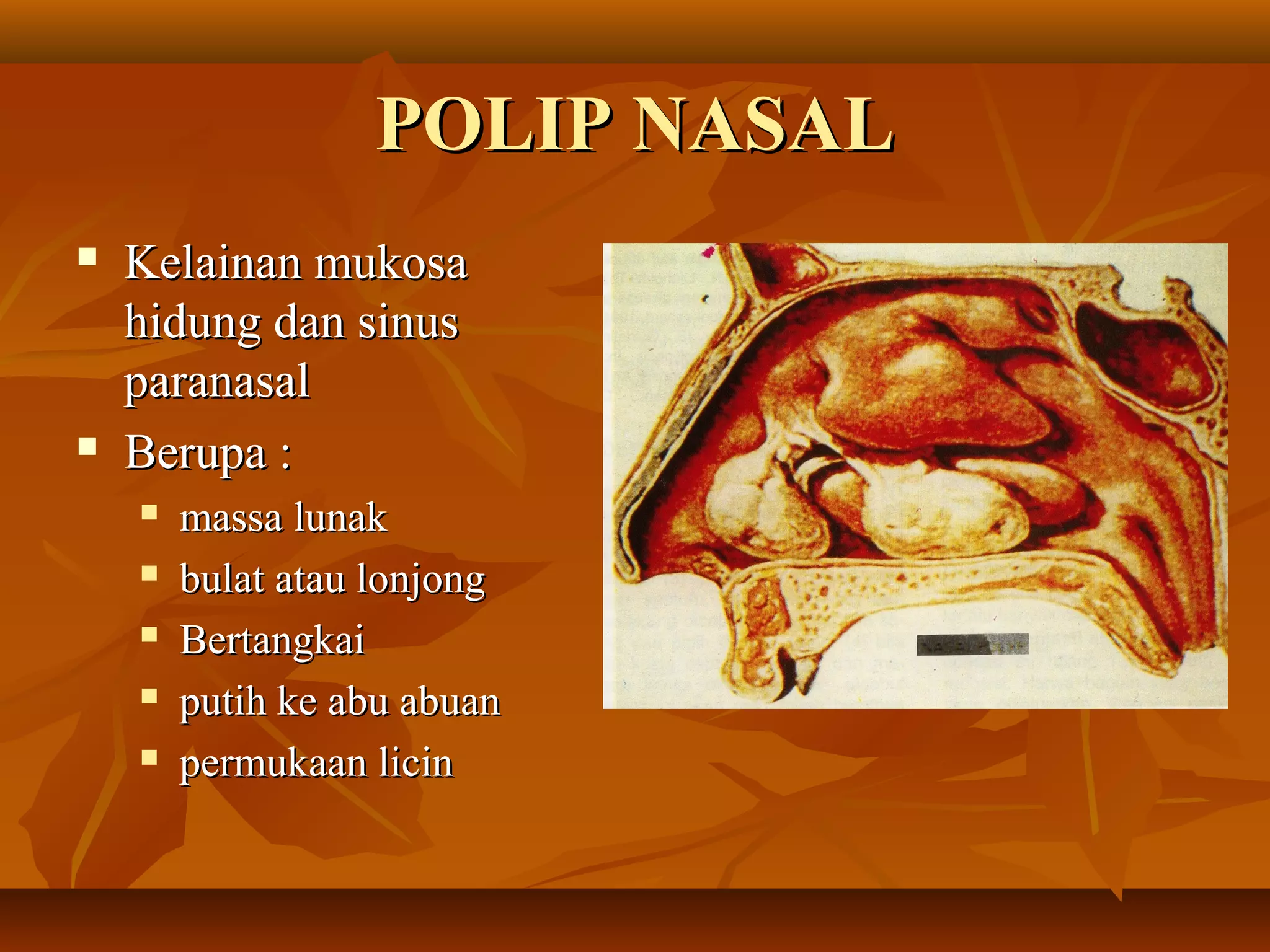 Anatomi hidung | PPT