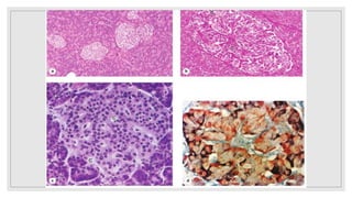 Anatomi, histologi, dan fisiologi pankreas.pptx