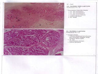 Anatomi histologi fisiologi mammae.ppt