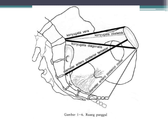Anatomi Jalan Lahir - Tulang, Otot, Ligamen.pptx