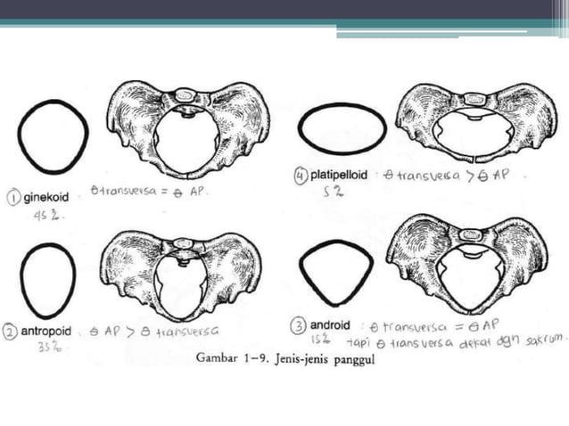 Anatomi Jalan Lahir - Tulang, Otot, Ligamen.pptx