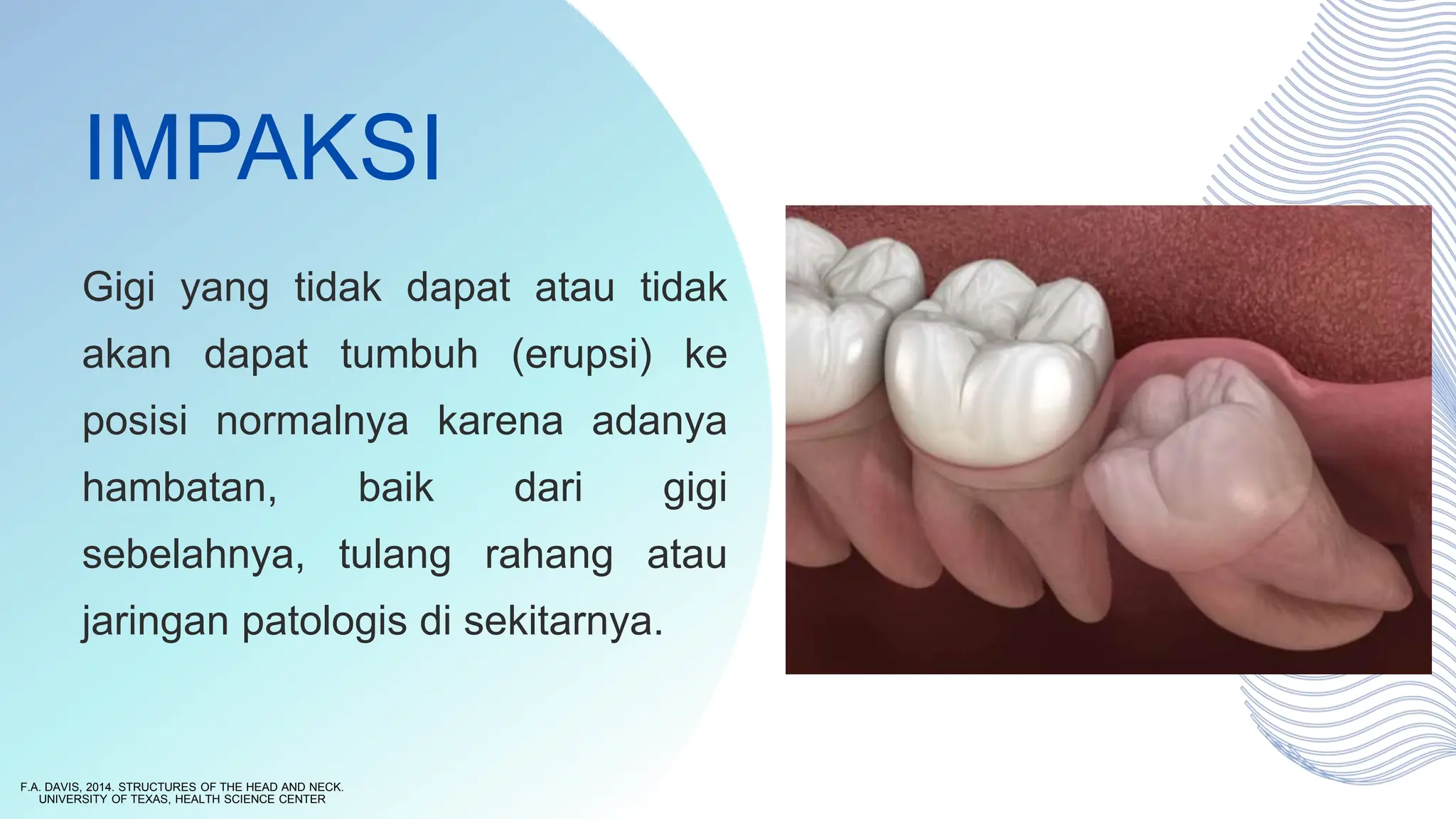 ANATOMI KEPALA SARAF ARTERI, VENA, OTOT, Dan Anatomi Impaksi Mandibular ...