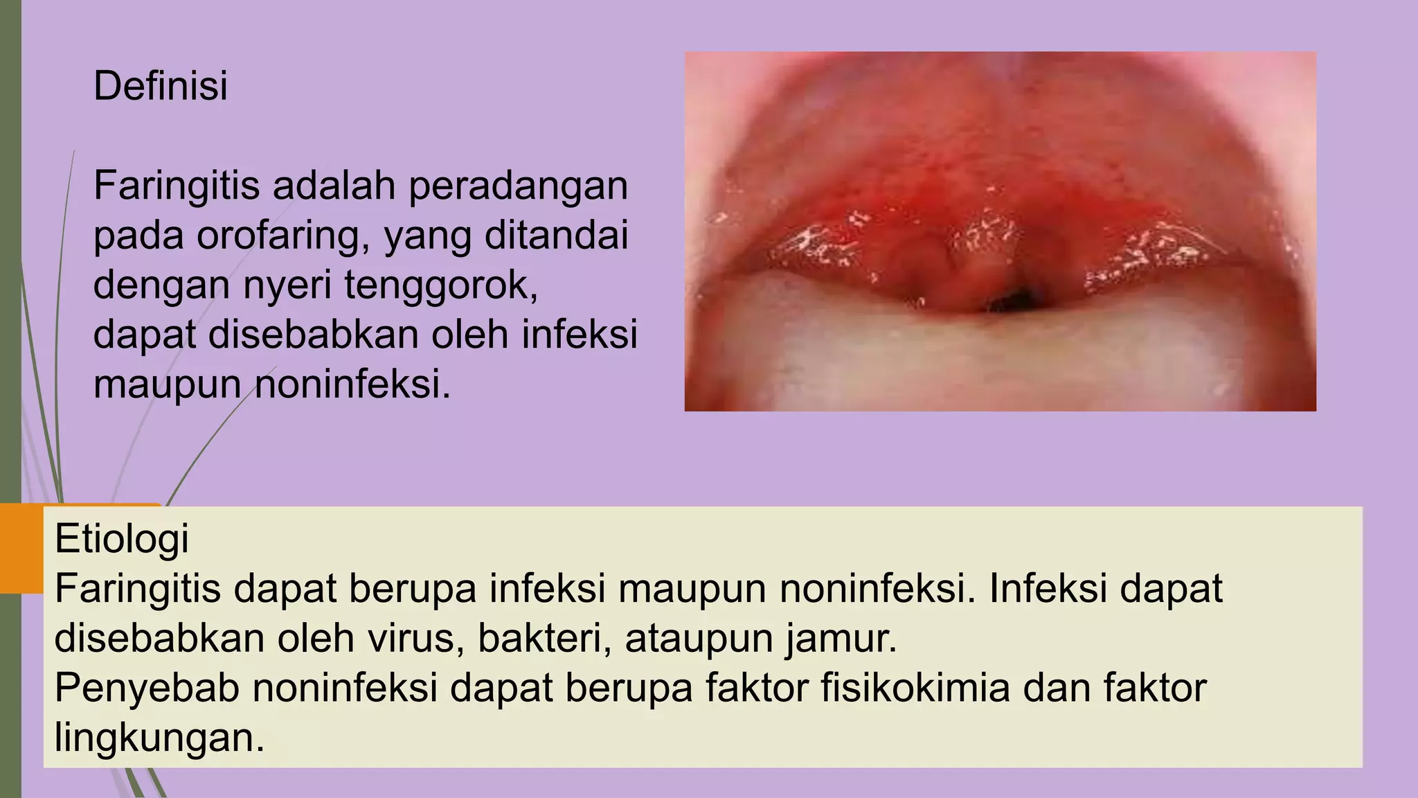 anatomi laring faring.pptx