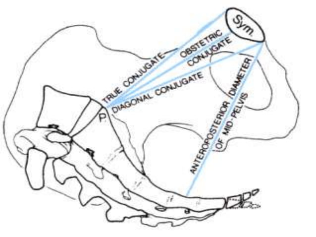 Anatomi panggul | PPTX
