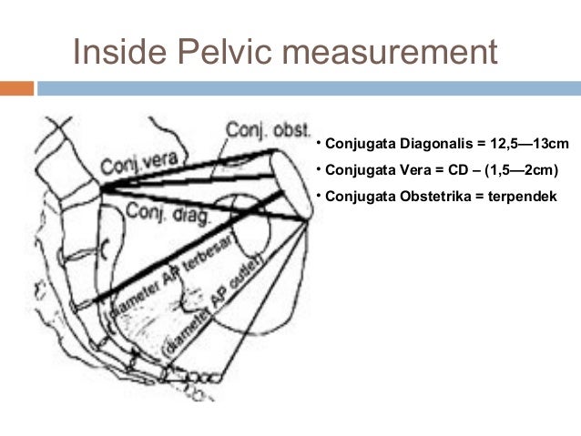 Anatomi panggul 2010
