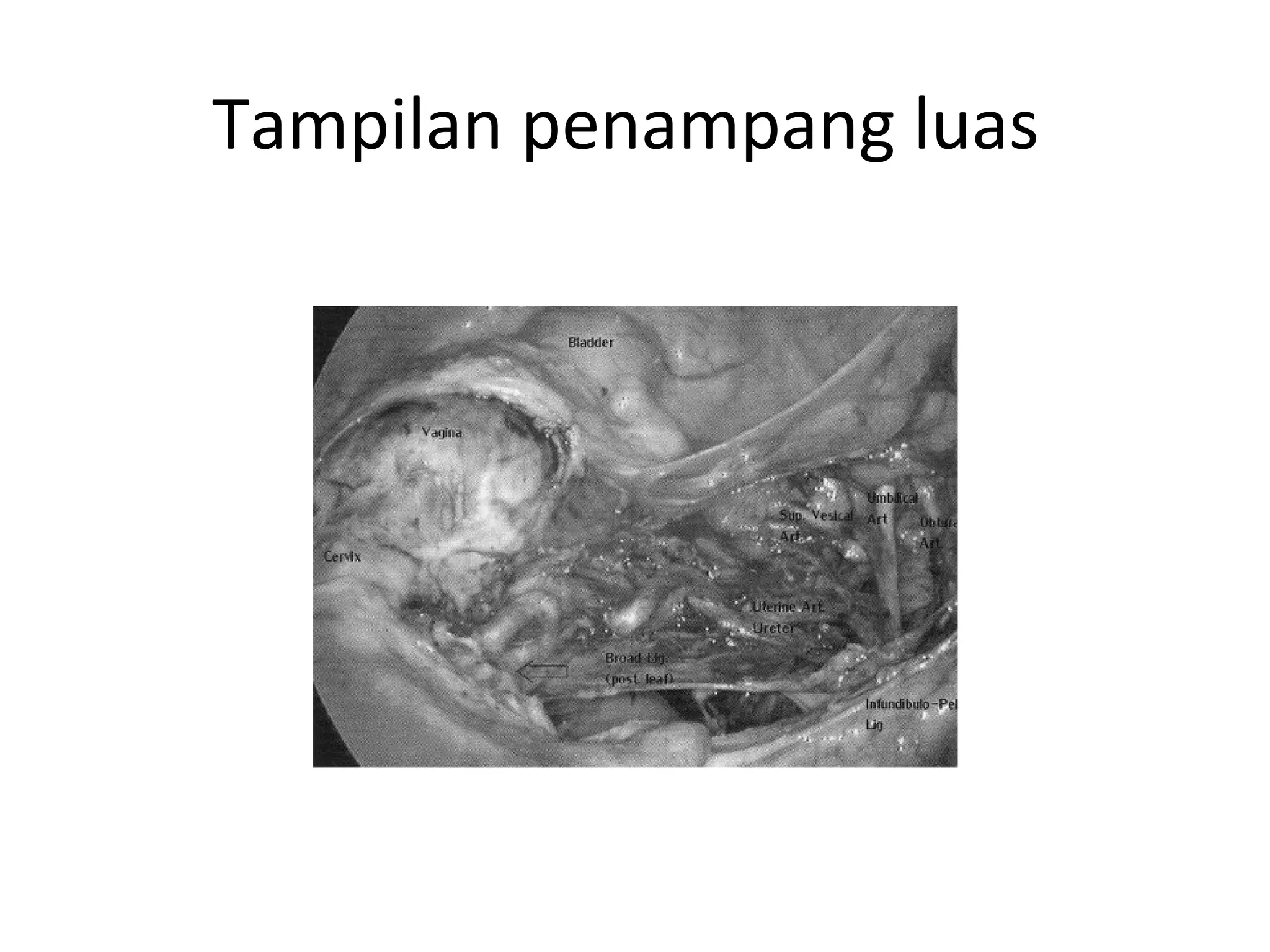 Anatomi pelvik untuk laparaskopi | PPT