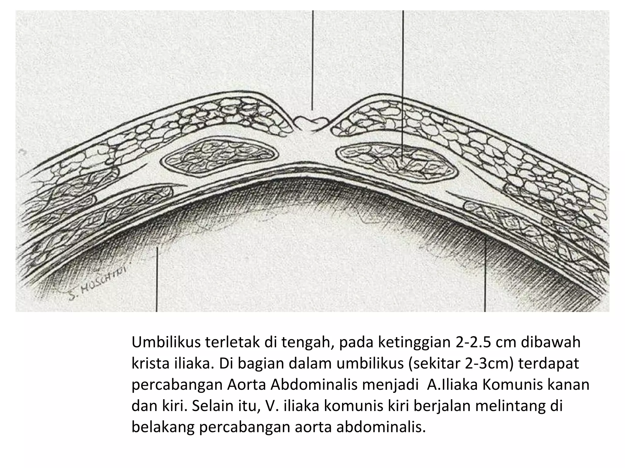 Anatomi pelvik untuk laparaskopi | PPT