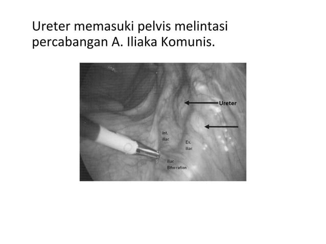 Anatomi pelvik untuk laparaskopi | PPT