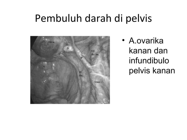 Anatomi pelvik untuk laparaskopi | PPT