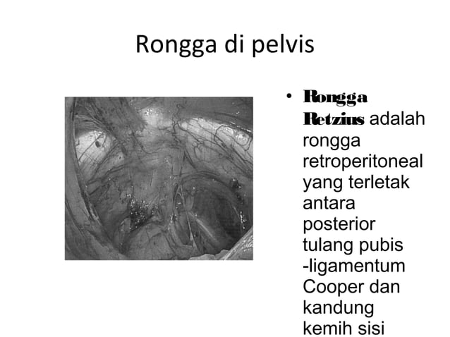 Anatomi pelvik untuk laparaskopi | PPT