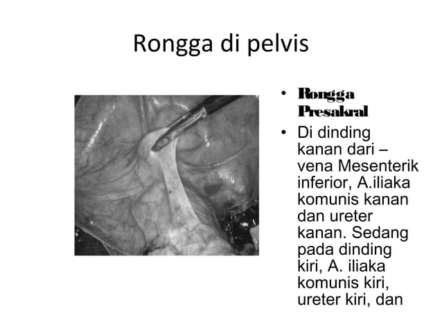 Anatomi pelvik untuk laparaskopi | PPT