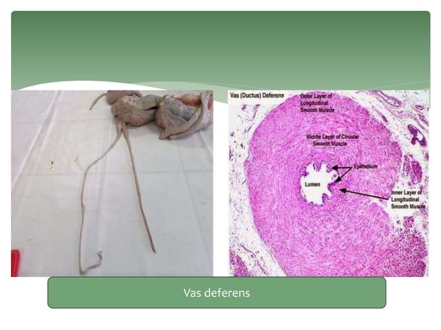 Anatomi reproduksi jantan dan betina pada sapi dan babi | PPTX