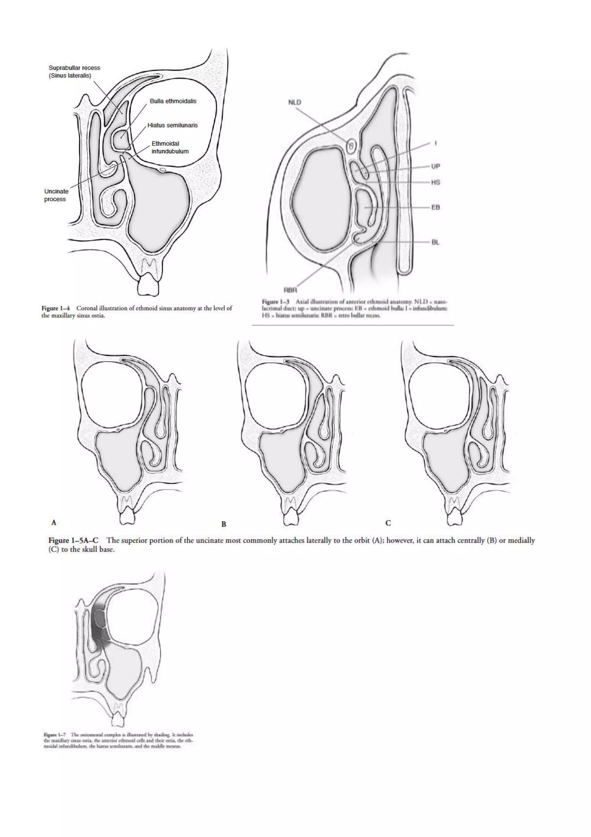 Anatomi sinus | DOCX