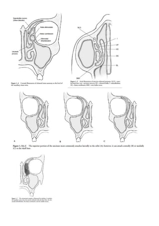 Anatomi sinus | DOCX