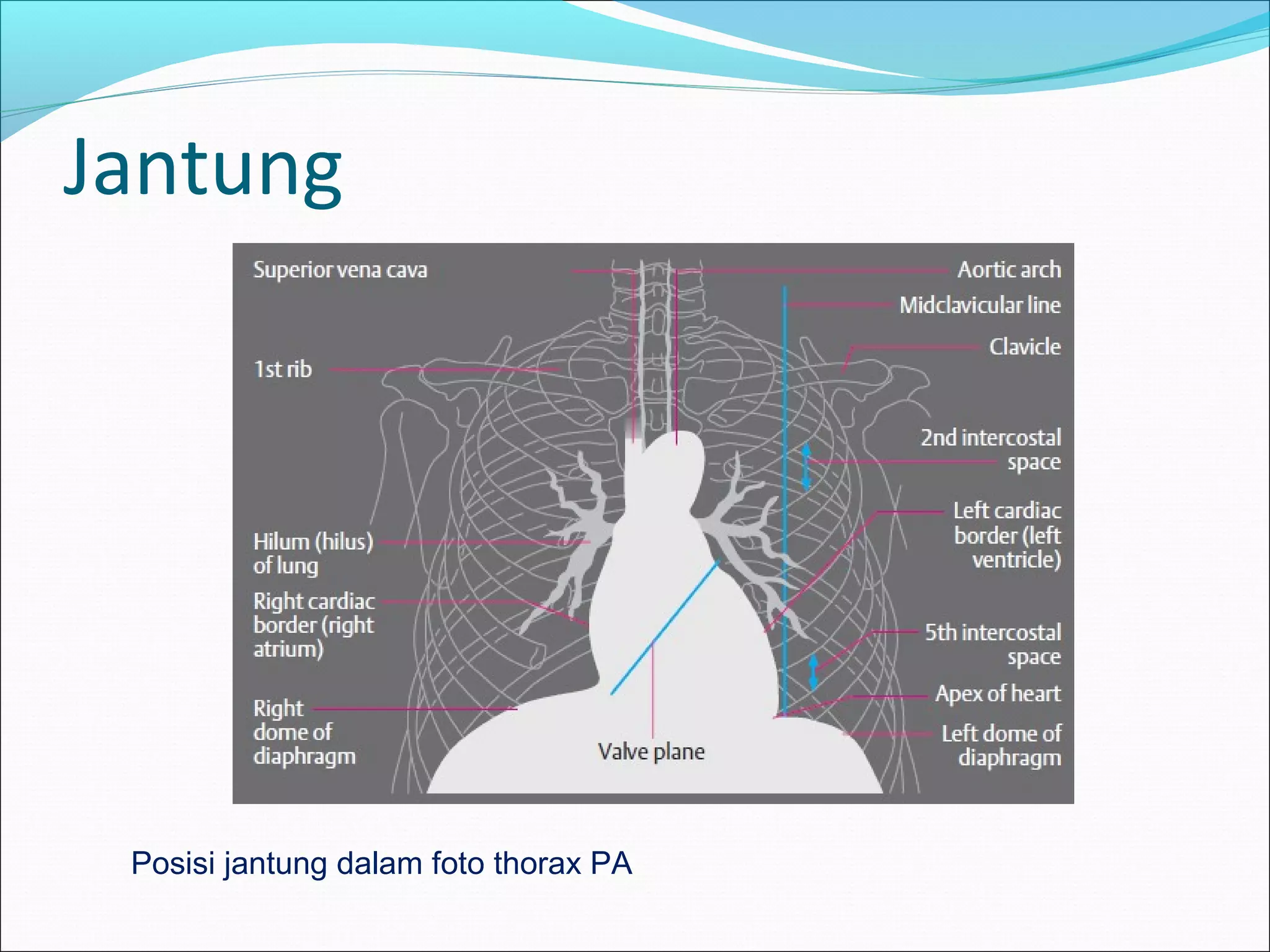 Anatomi sistem kardiovaskuler | PPT