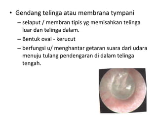 Anatomi telinga tengah ruptur mt oma | PPT