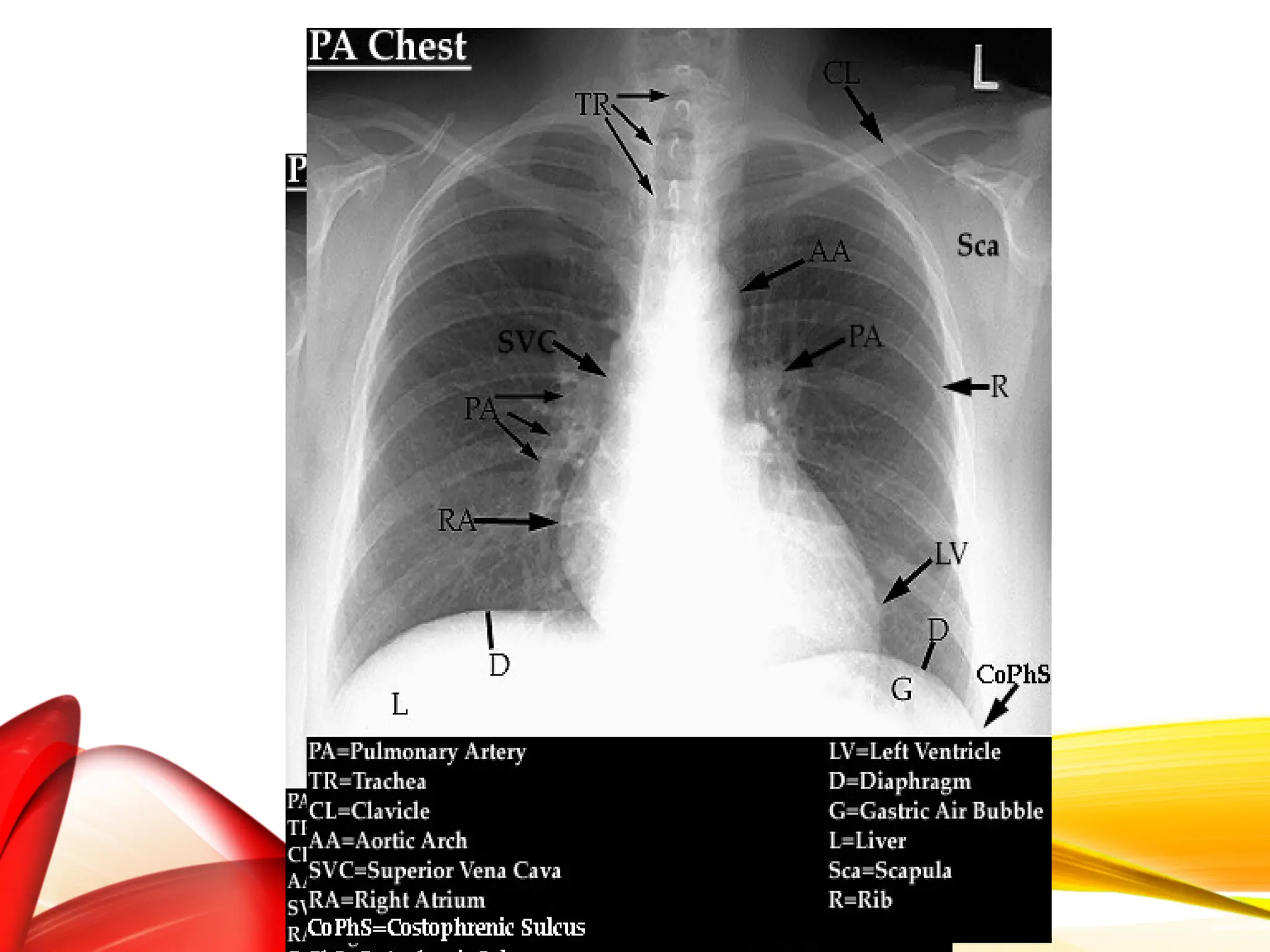 ANATOMI THORAKS Basic for Radiologi.pptx