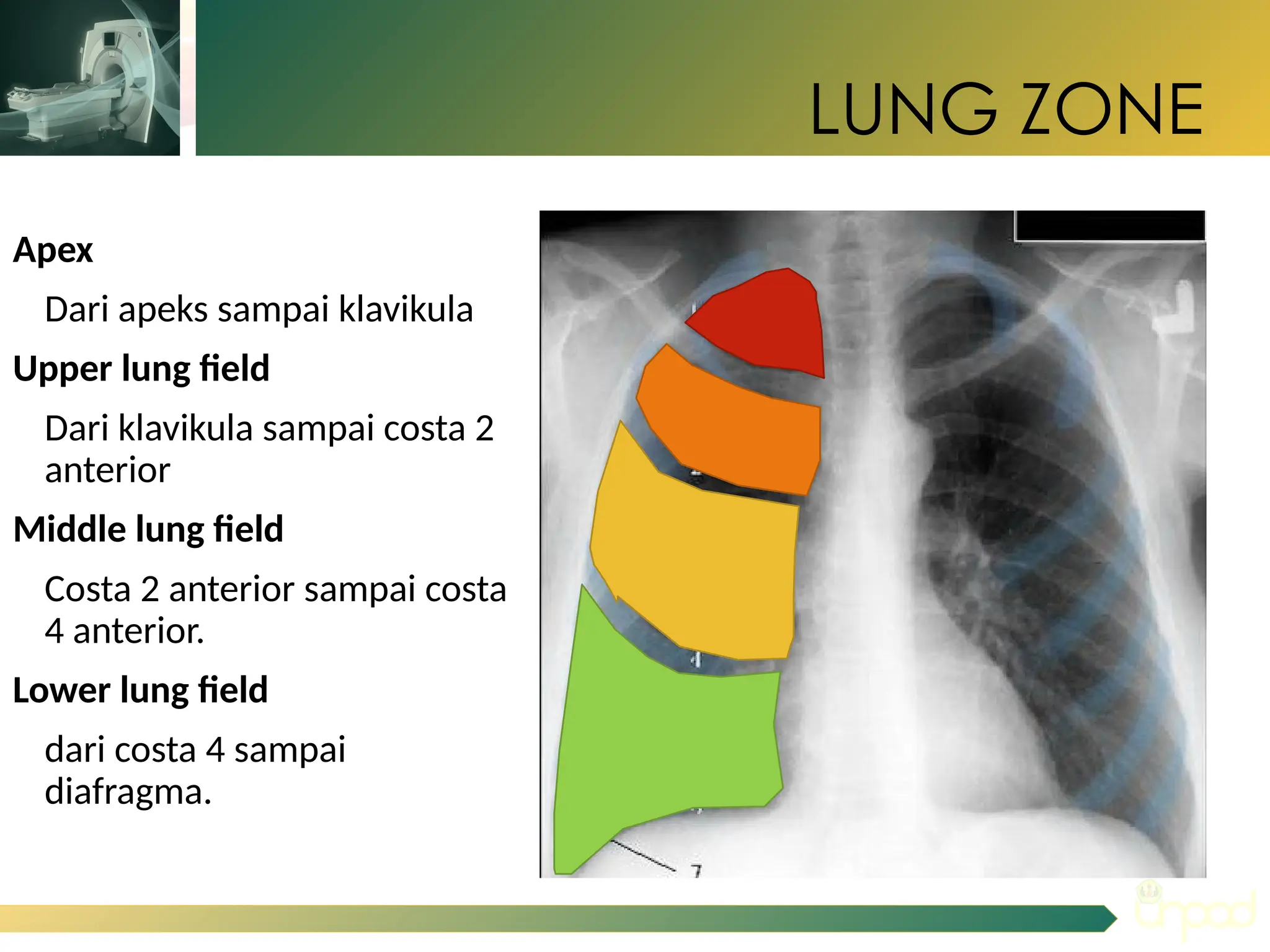 ANATOMI THORAKS Basic for Radiologi.pptx