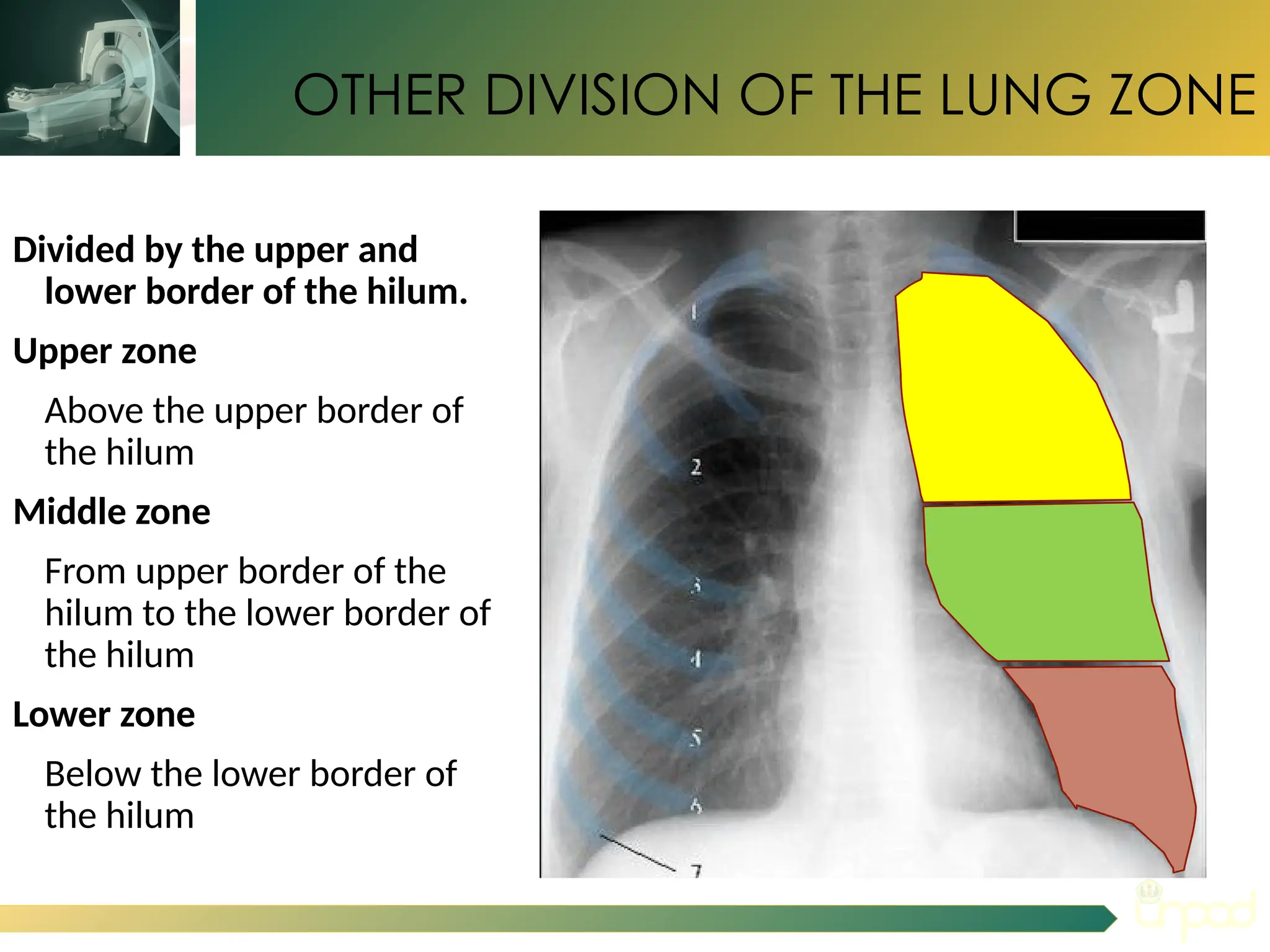ANATOMI THORAKS Basic for Radiologi.pptx