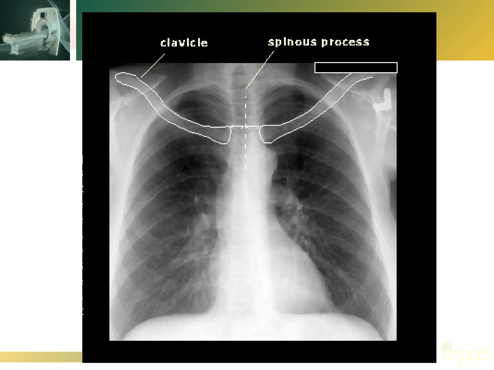 ANATOMI THORAKS Basic for Radiologi.pptx