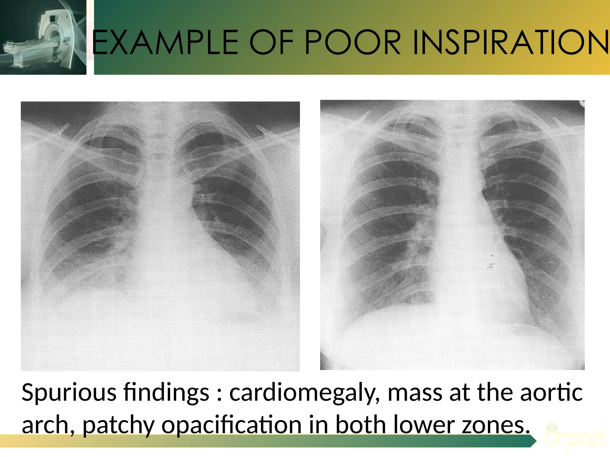 ANATOMI THORAKS Basic for Radiologi.pptx
