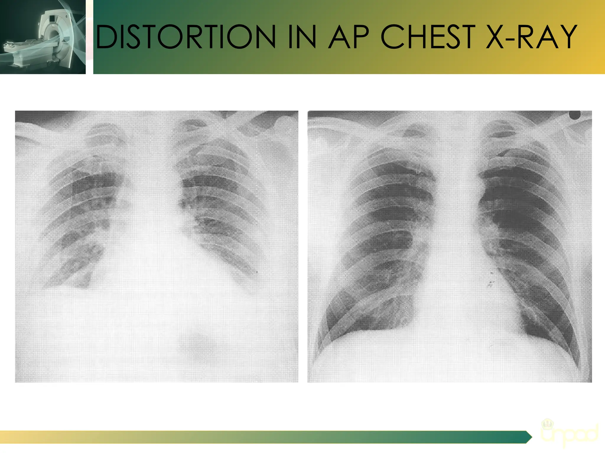 ANATOMI THORAKS Basic for Radiologi.pptx