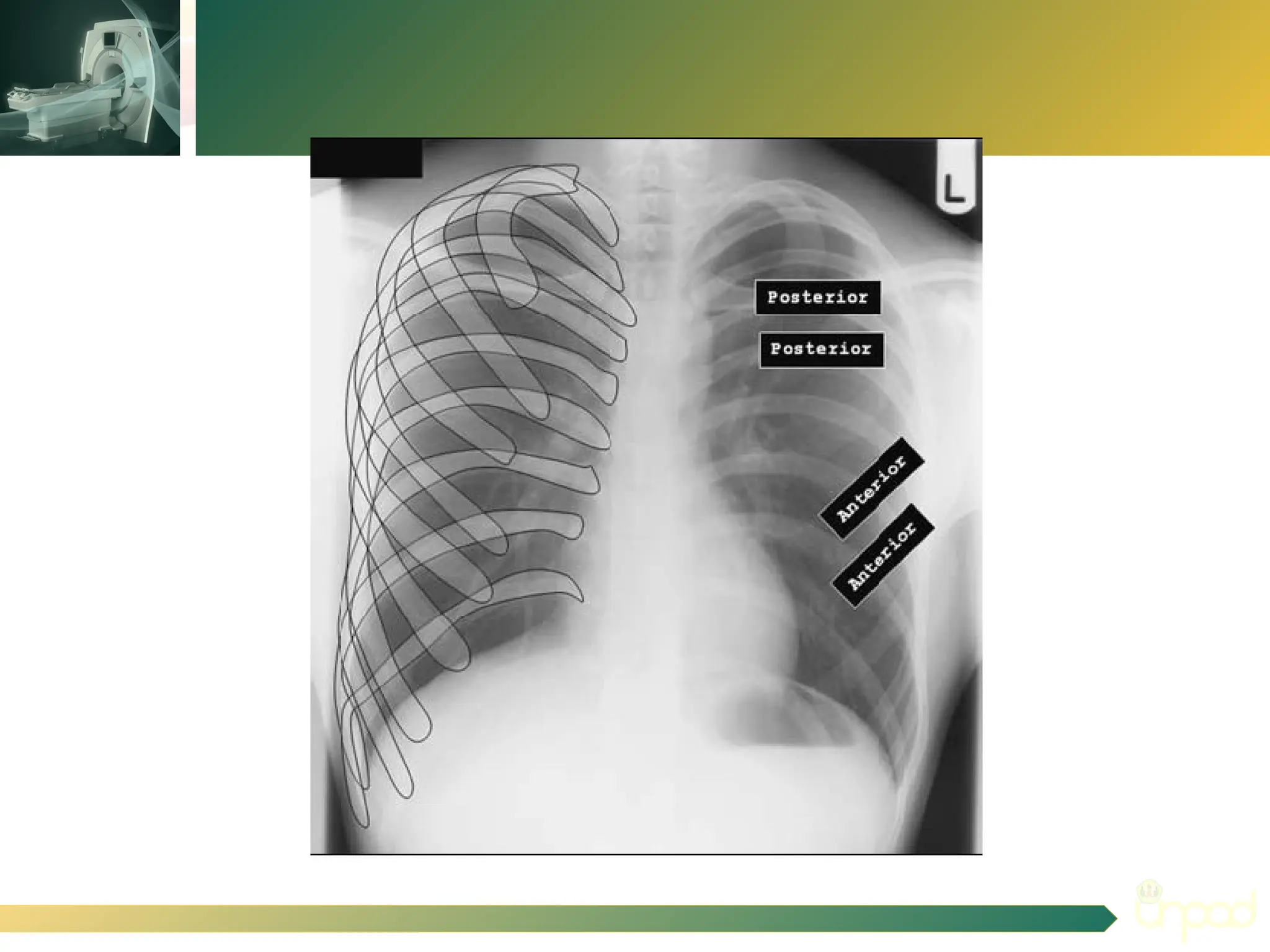 ANATOMI THORAKS Basic for Radiologi.pptx
