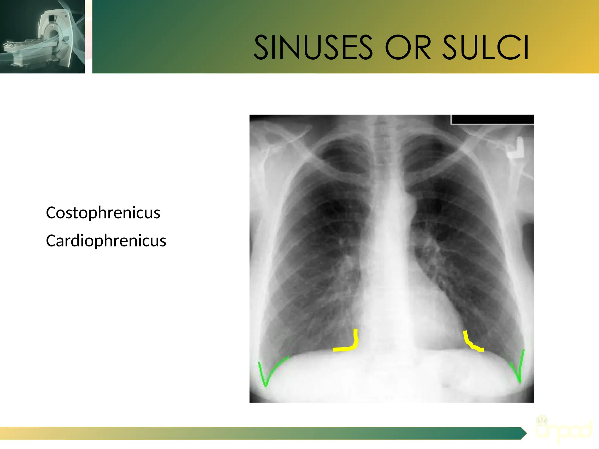 ANATOMI THORAKS Basic for Radiologi.pptx