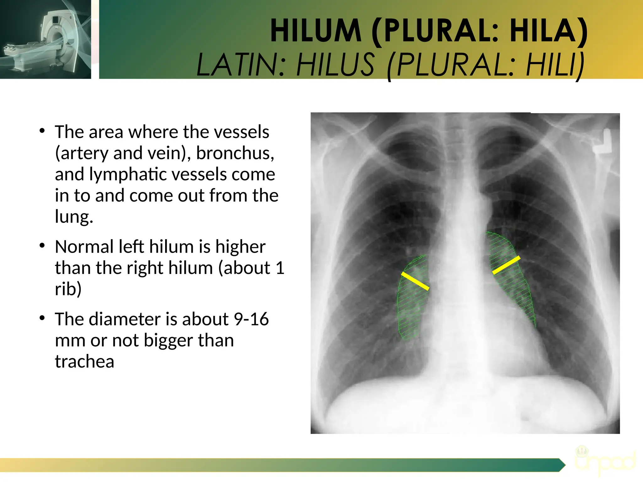 ANATOMI THORAKS Basic for Radiologi.pptx
