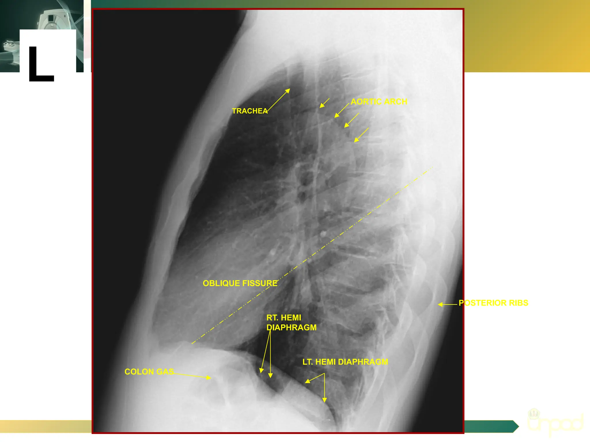 ANATOMI THORAKS Basic for Radiologi.pptx