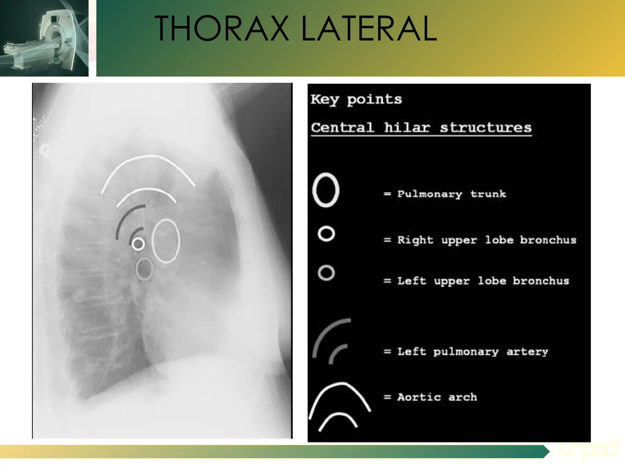 ANATOMI THORAKS Basic for Radiologi.pptx