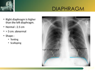 ANATOMI THORAKS Basic for Radiologi.pptx