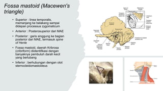 Anatomi Tulang Temporal dan Dasar Tengkorak.pptx