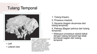 Anatomi Tulang Temporal dan Dasar Tengkorak.pptx