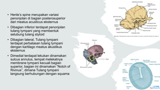 Anatomi Tulang Temporal dan Dasar Tengkorak.pptx