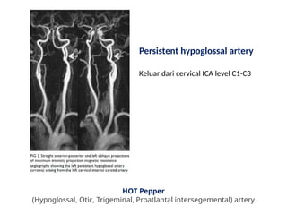 Anatomi Vertebrobasiler dan Posterior Cerebral Artery - Fajar.pptx