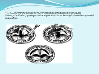 Anatomiya Lab-tanglay anomaliyasi. Ularda kuzatiladigan patologiyalar | PPT