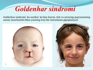 Anatomiya Lab-tanglay anomaliyasi. Ularda kuzatiladigan patologiyalar | PPT